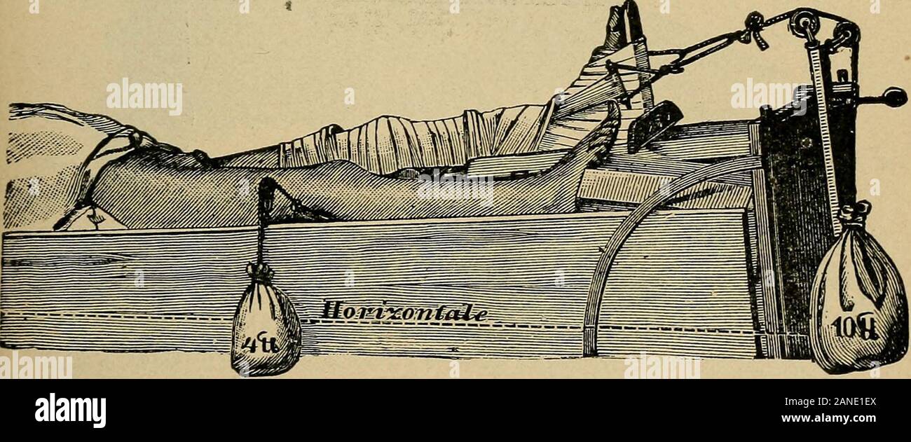 Lateral traction hi-res stock photography and images - Alamy