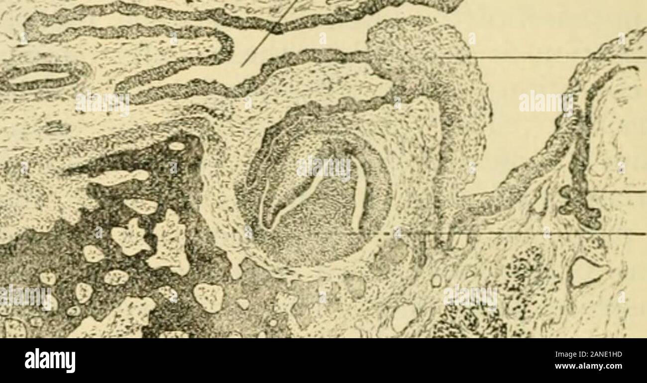 Dental papilla hi-res stock photography and images - Alamy