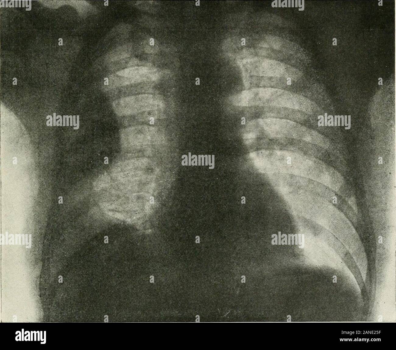 Diseases of the chest and the principles of physical diagnosis . ion ...
