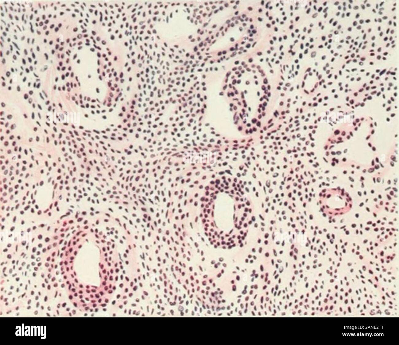 Gross pathology hi-res stock photography and images - Alamy