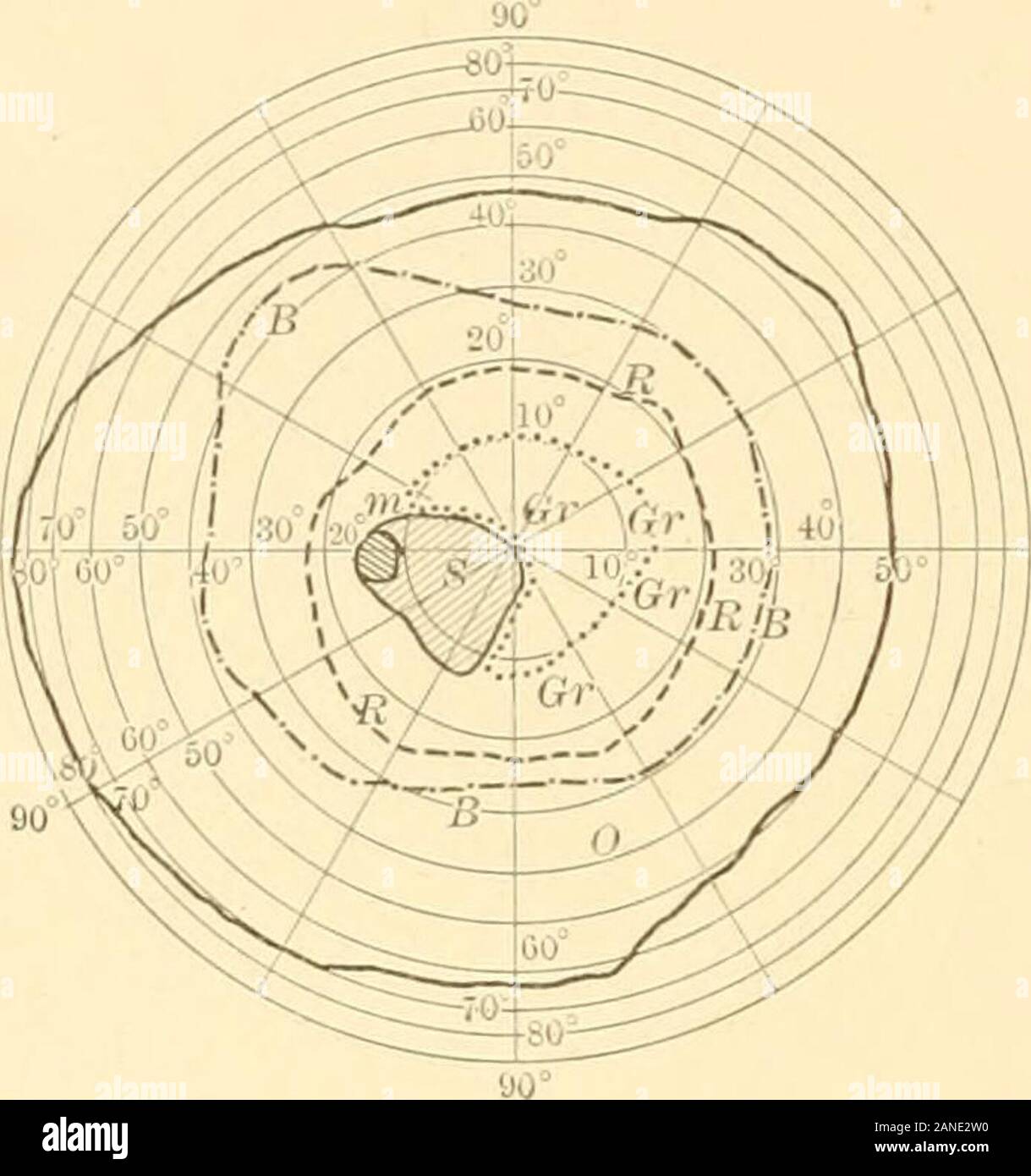 Scotoma hi-res stock photography and images - Alamy