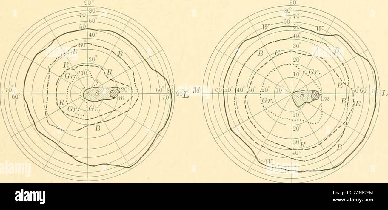 Scotoma hi-res stock photography and images - Alamy