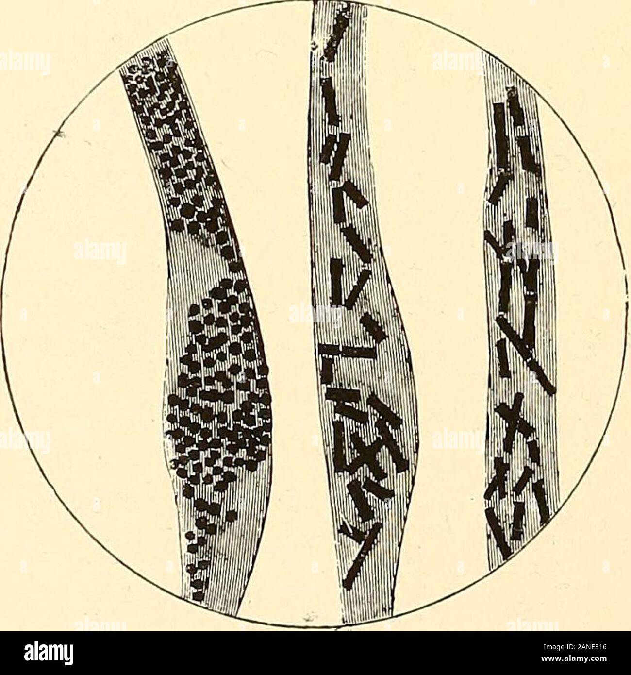 Principles and practice of operative dentistry . Fig. 274.—Undermining ...