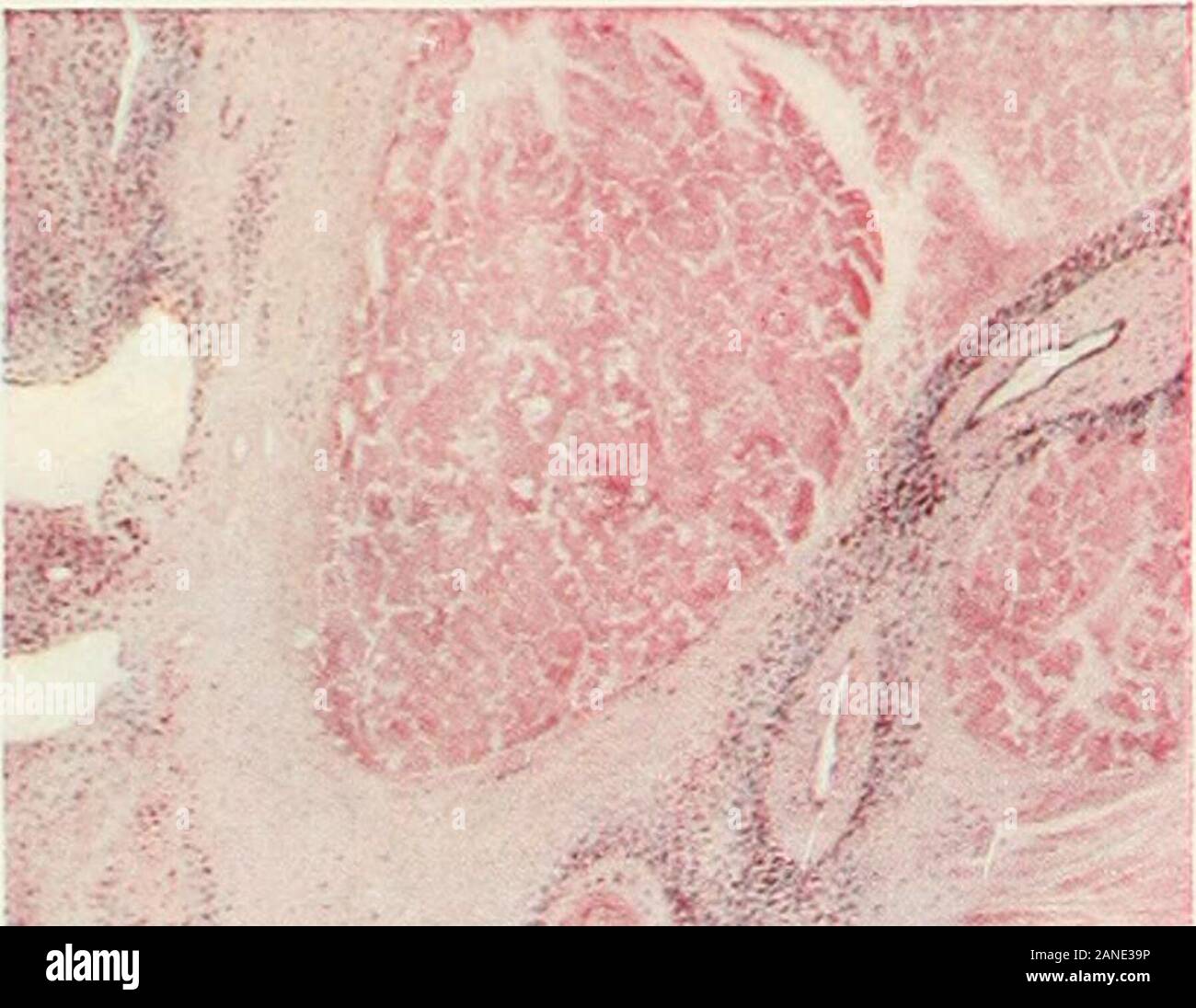 Intraligamentary hi-res stock photography and images - Alamy