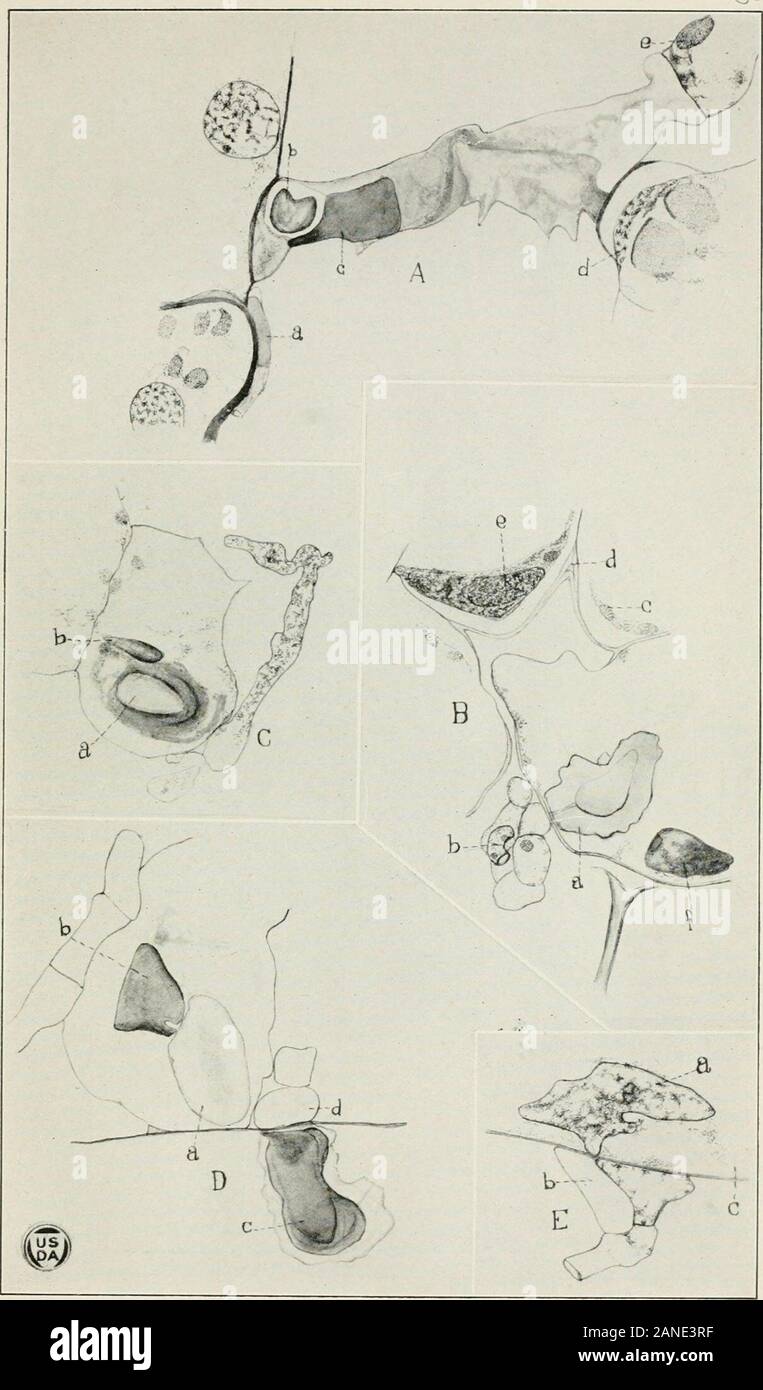 Neck stoma hi-res stock photography and images - Alamy