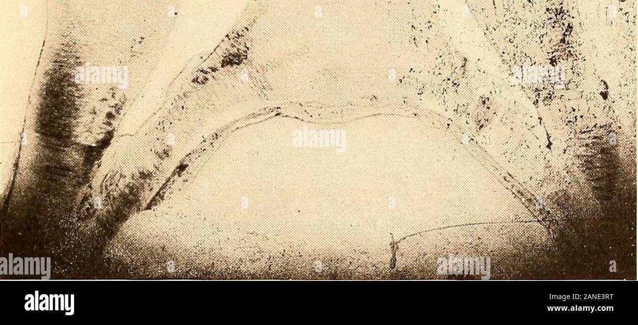 Principles and practice of operative dentistry . Fig. 272.—Vertical ...