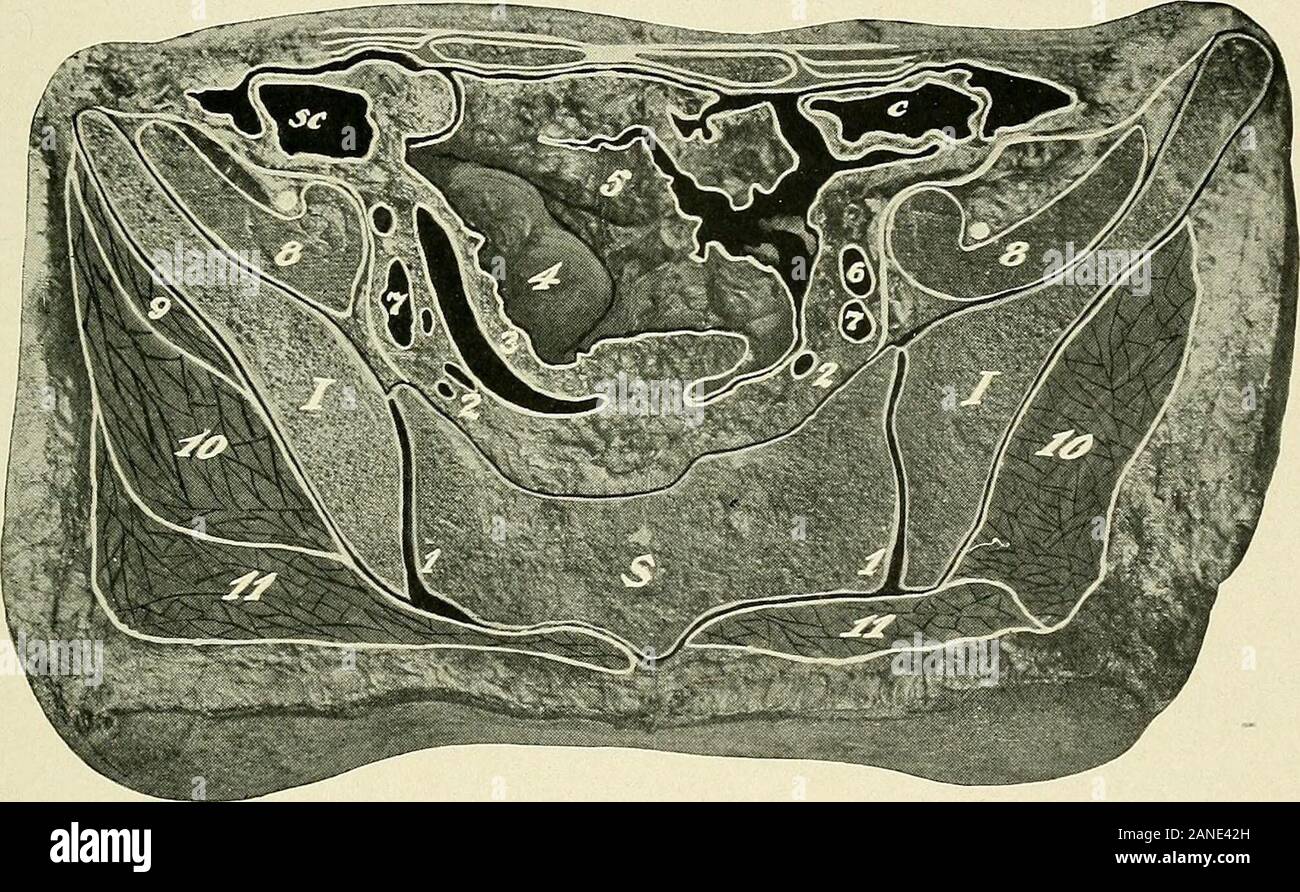 Pelvic arteries hi-res stock photography and images - Alamy