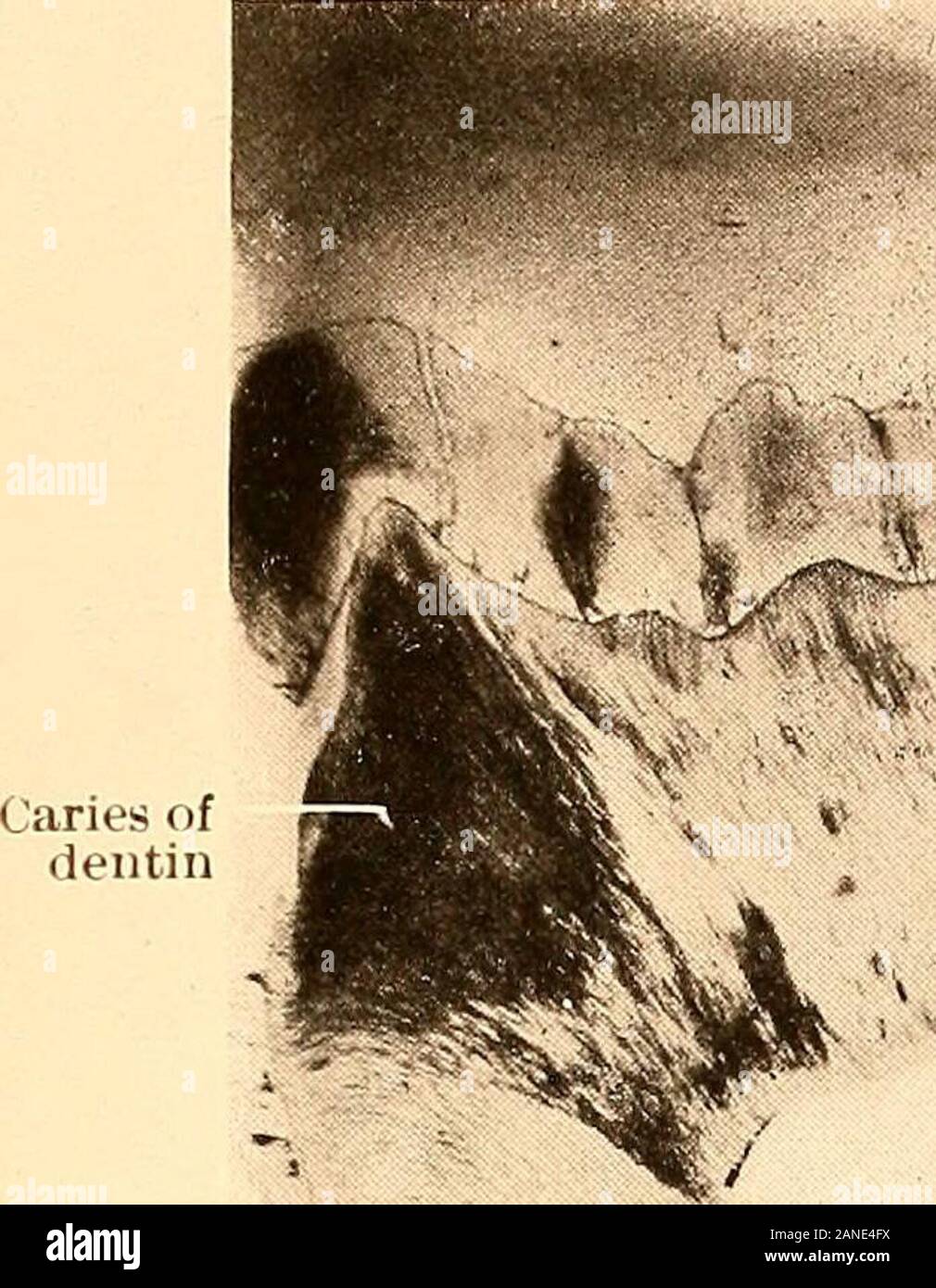 Walkhoff hi-res stock photography and images - Alamy