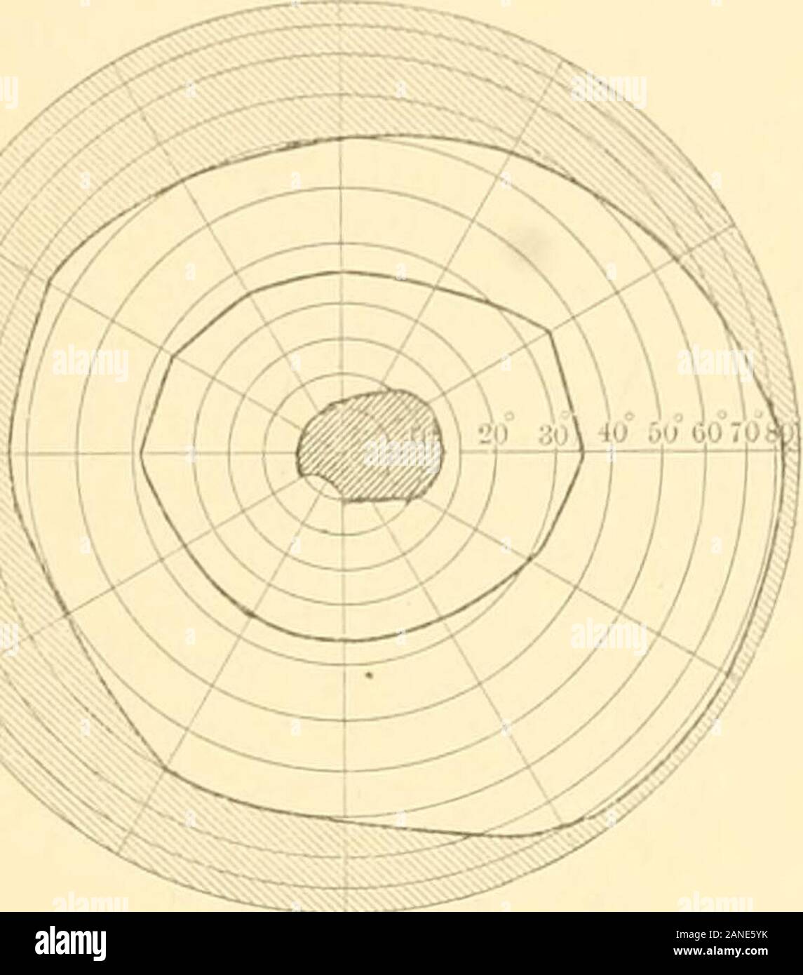Toxic amblyopia hi-res stock photography and images - Alamy