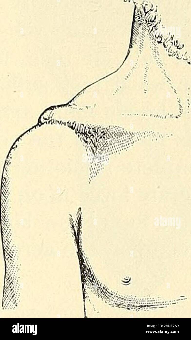 Clavicular hi-res stock photography and images - Alamy