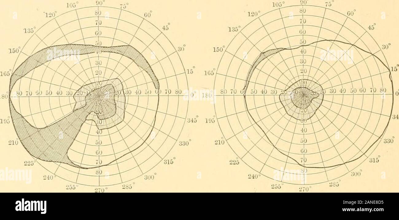 The toxic amblyopias: their classification, history, symptoms ...