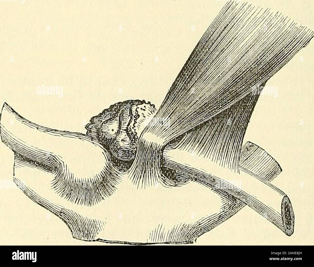 Sternal fractures hi-res stock photography and images - Alamy