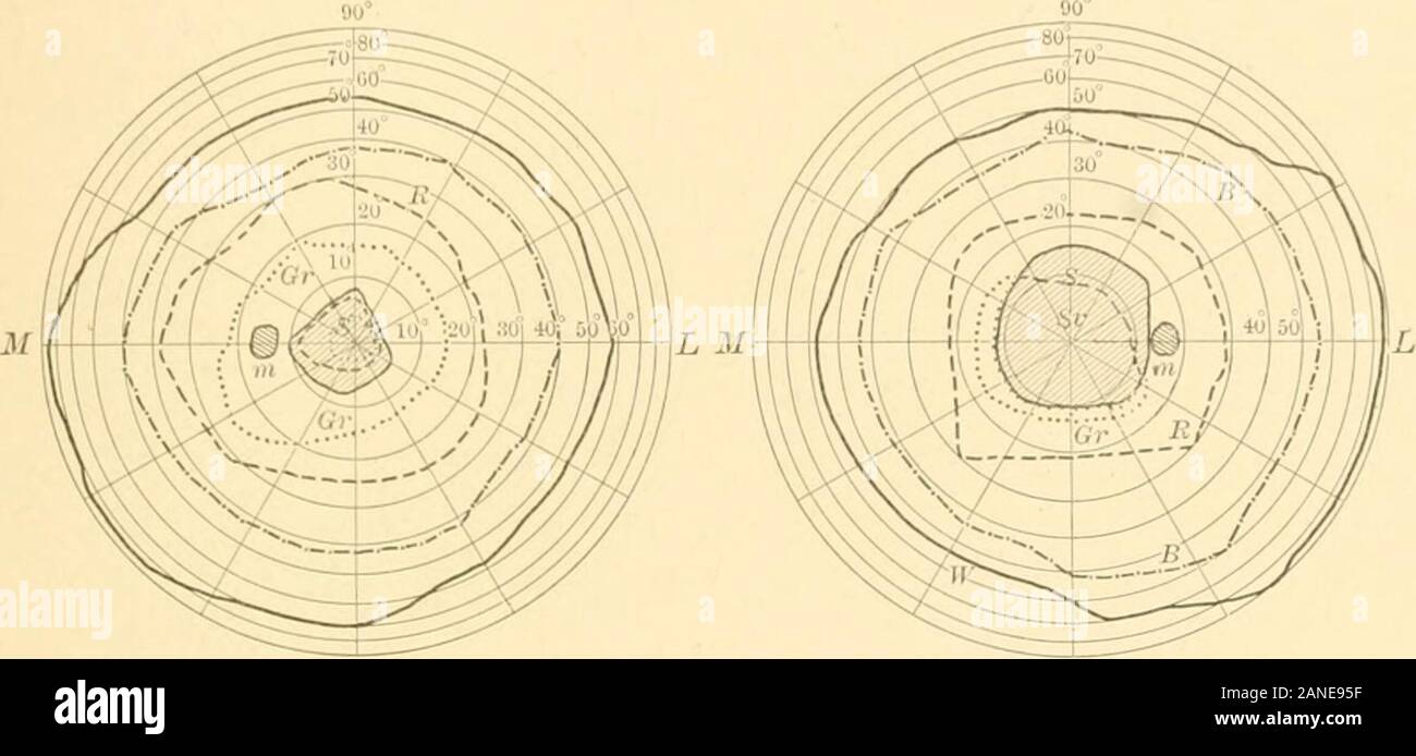 Scotoma hi-res stock photography and images - Alamy
