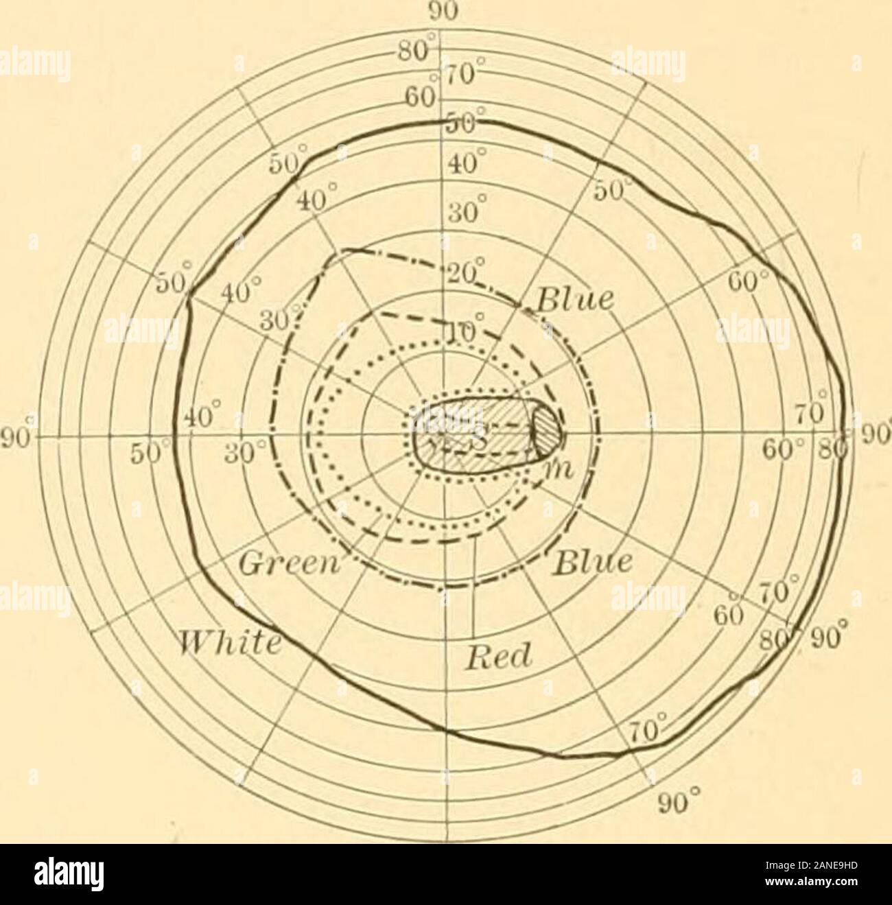 Toxic amblyopia hi-res stock photography and images - Alamy