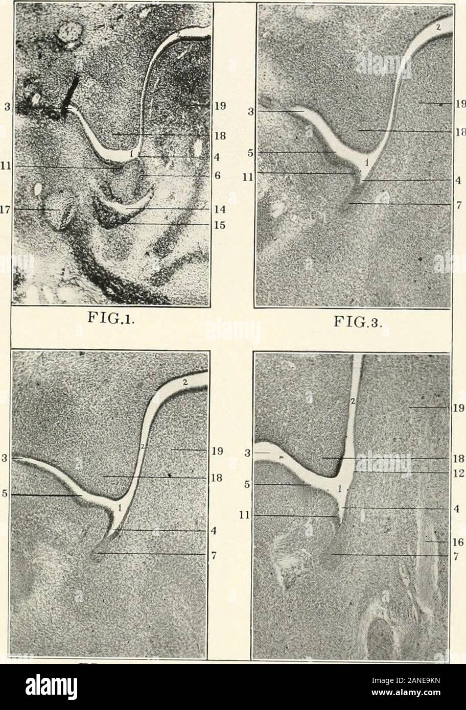 Pig embryo hi-res stock photography and images - Alamy