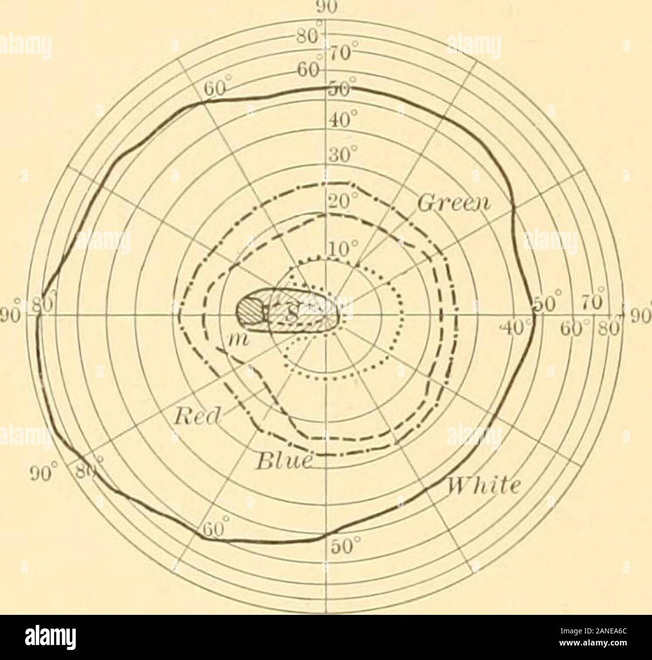 The toxic amblyopias: their classification, history, symptoms ...