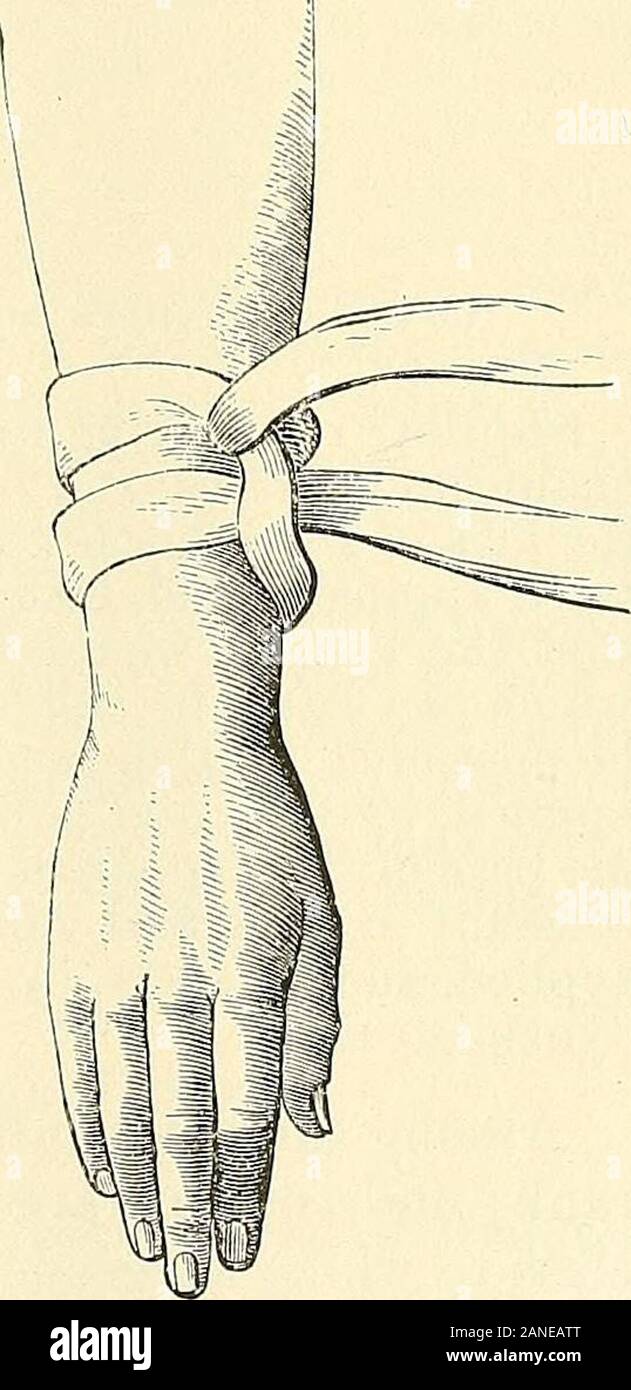 Seizing limb hi-res stock photography and images - Alamy