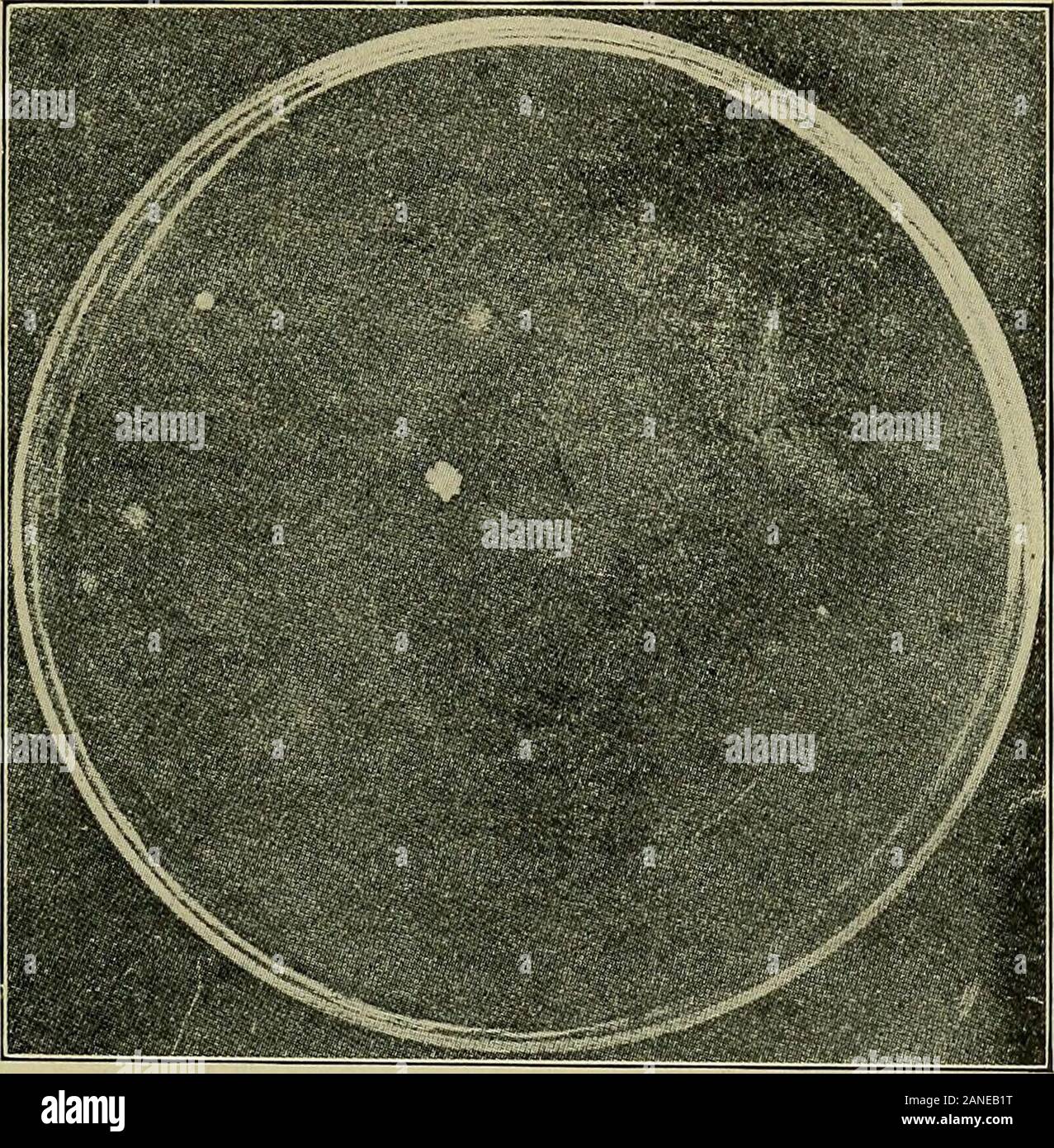 Tem bacteria hi-res stock photography and images - Alamy