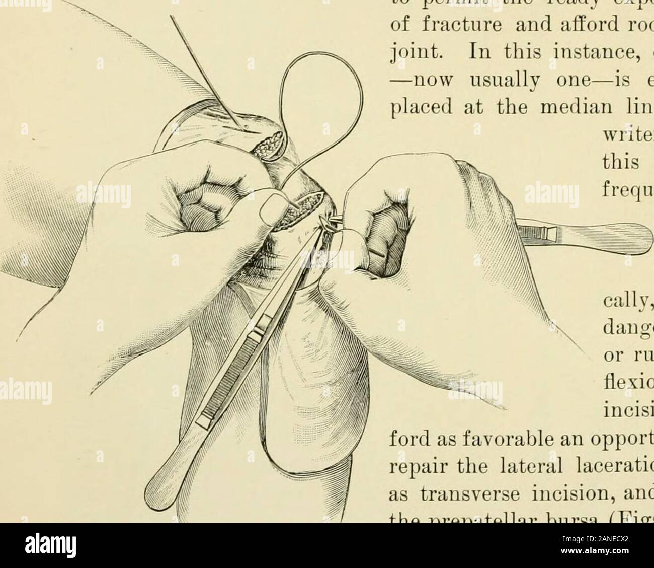 Prepatellar bursa hi-res stock photography and images - Alamy