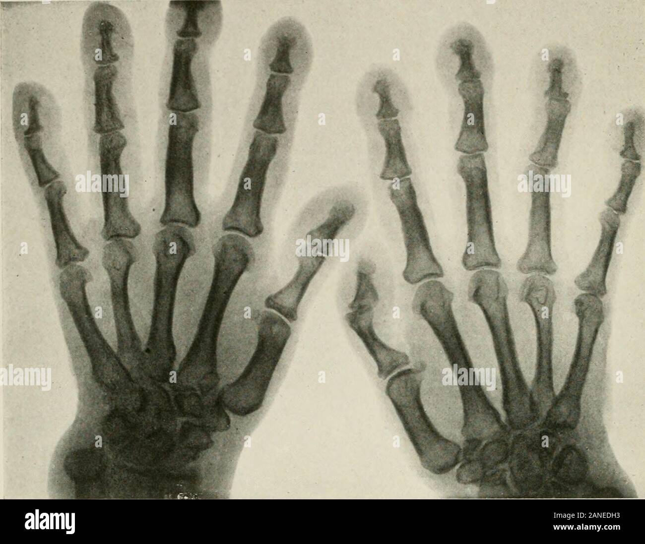 Godlee hi-res stock photography and images - Alamy