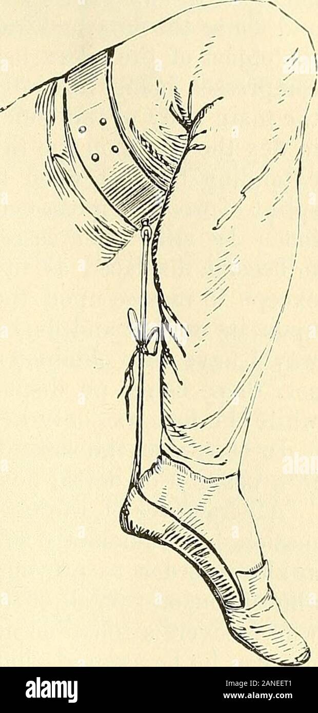 A practical treatise on fractures and dislocations . on, by seizing the ...