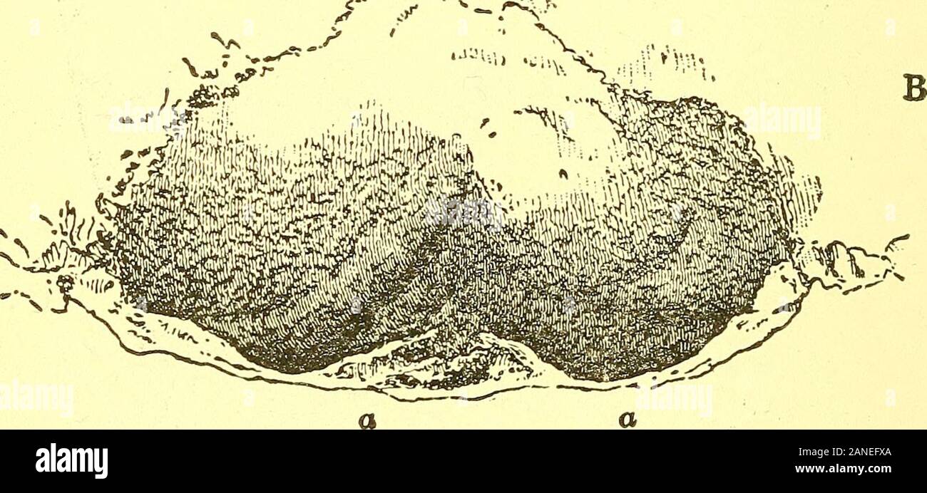 Squamosal Suture