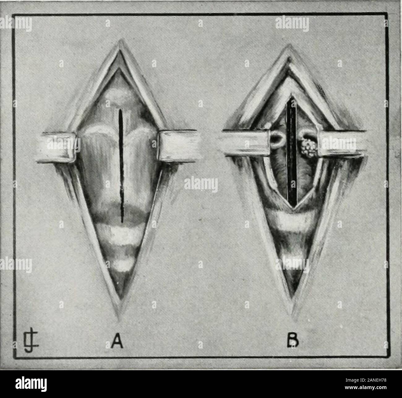 Turbinotome hi-res stock photography and images - Alamy