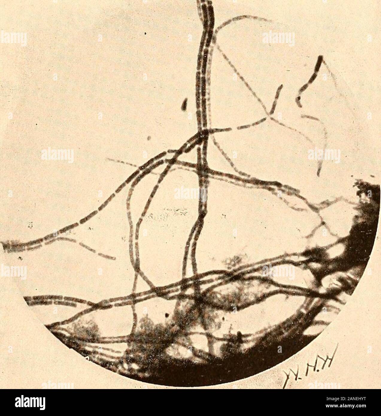 Principles and practice of operative dentistry . riG. 249.—Leptothrix ...