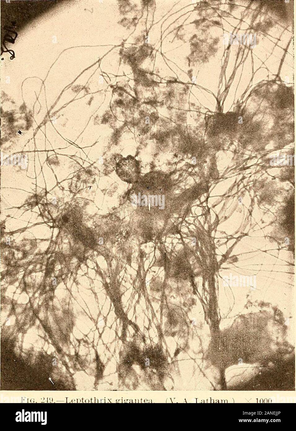 Leptothrix hi-res stock photography and images - Alamy