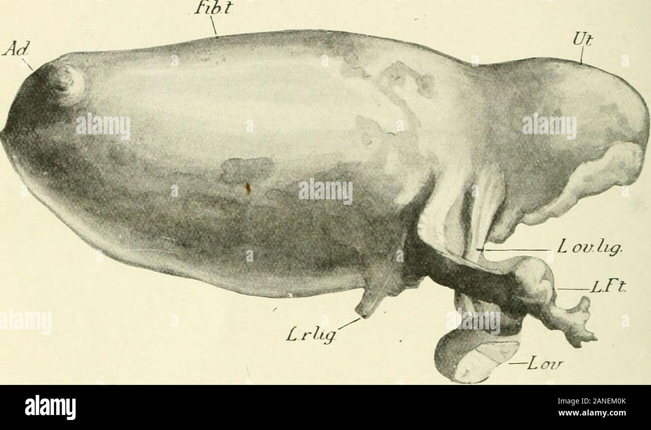 Intraligamentary hi-res stock photography and images - Alamy