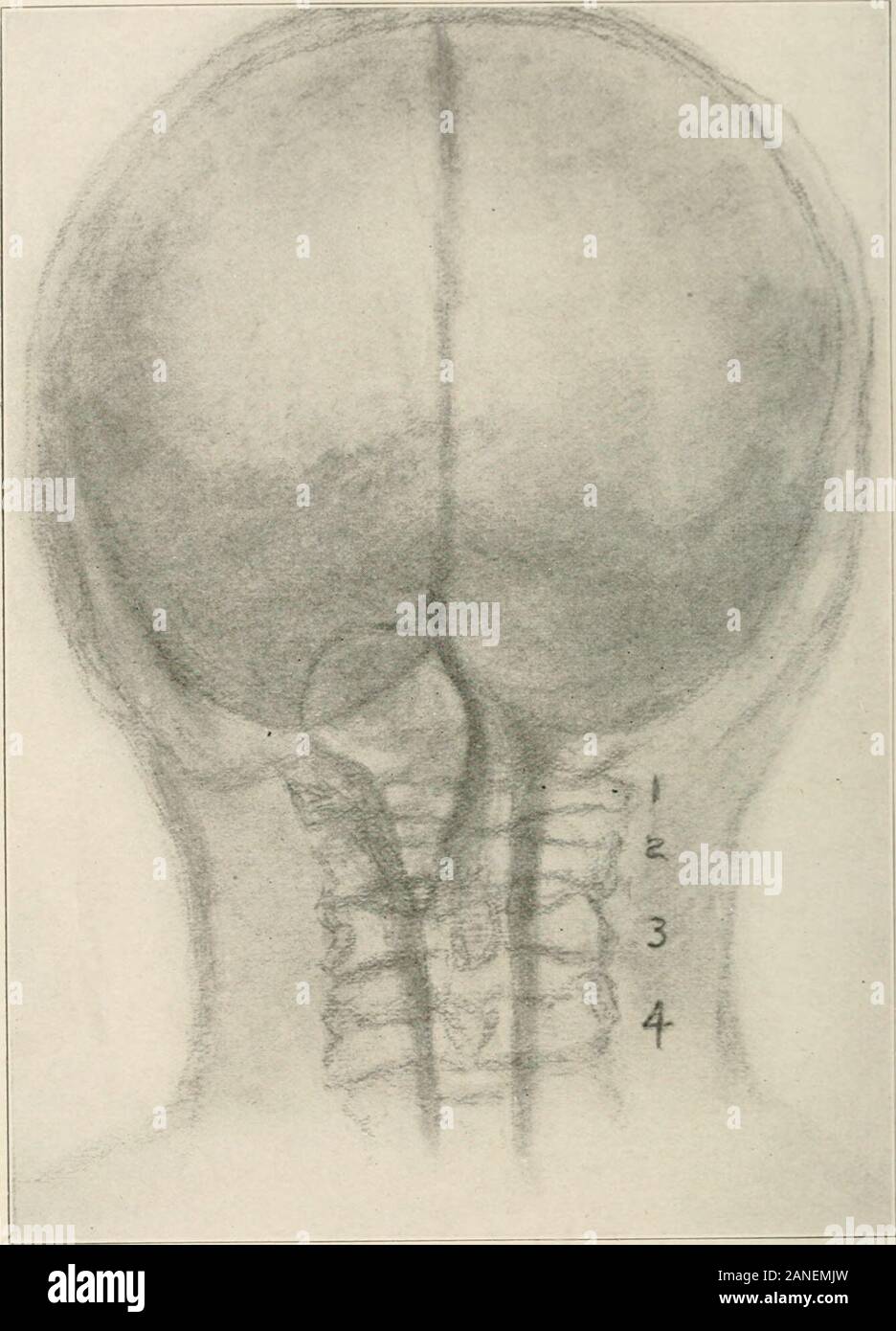Epigastrium hi-res stock photography and images - Alamy