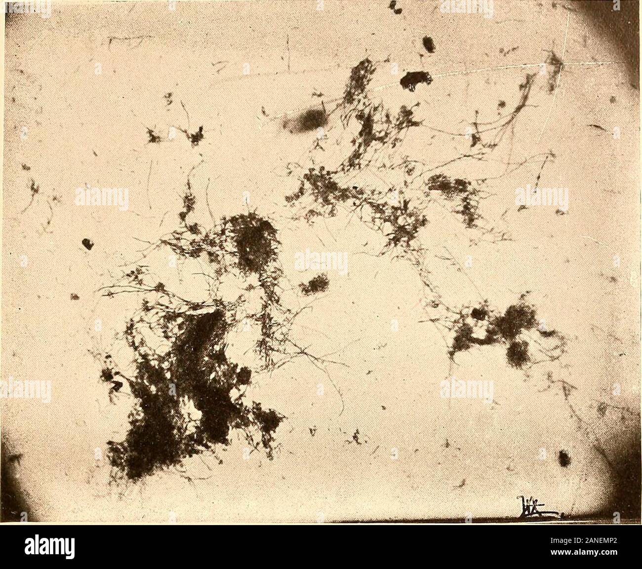 Leptothrix buccalis hi-res stock photography and images - Alamy