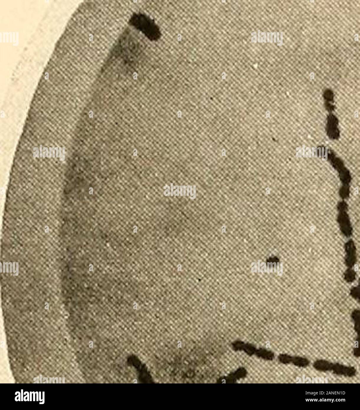 Streptococcus pyogenes hi-res stock photography and images - Alamy