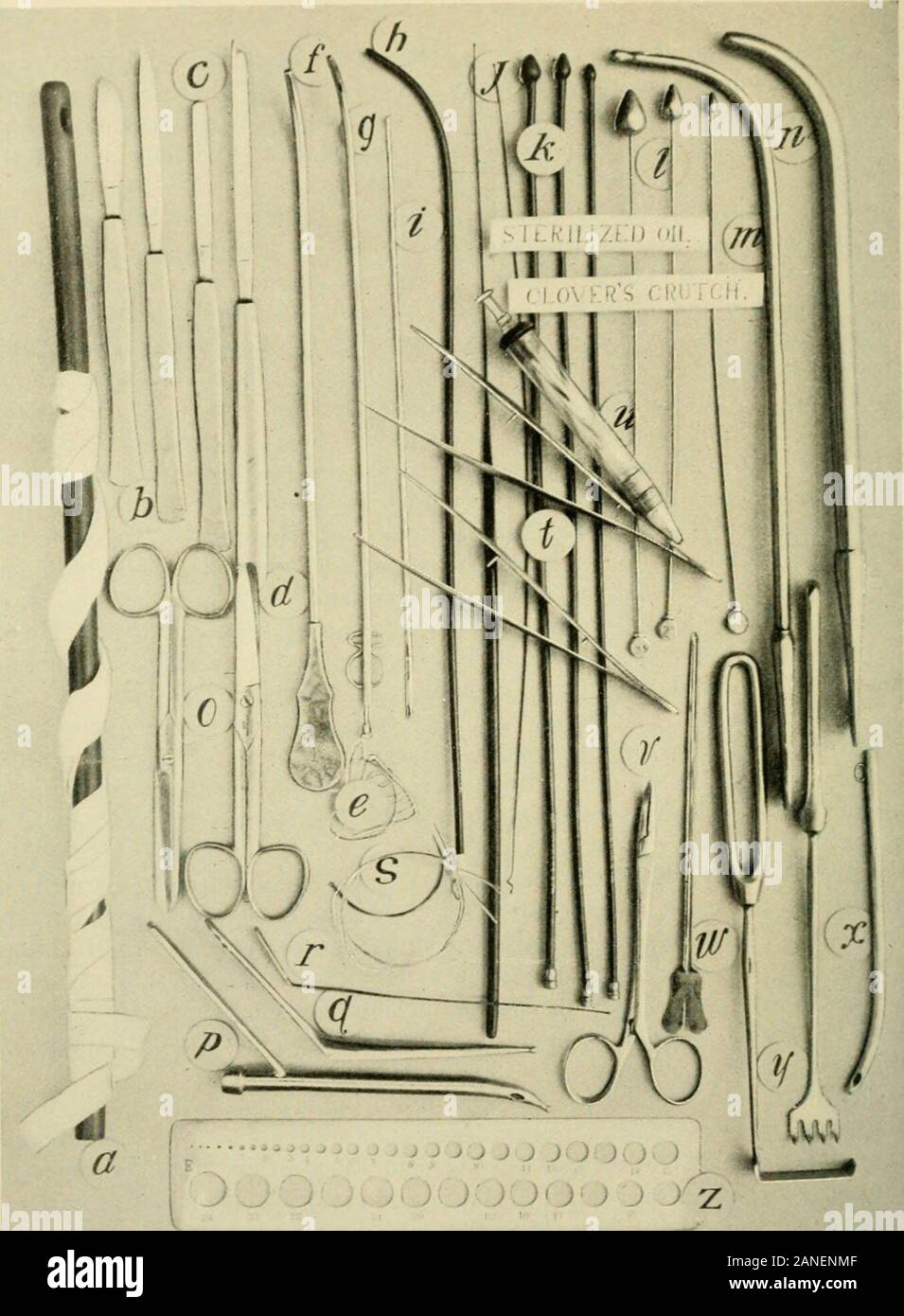 Urethrectomy hi-res stock photography and images - Alamy