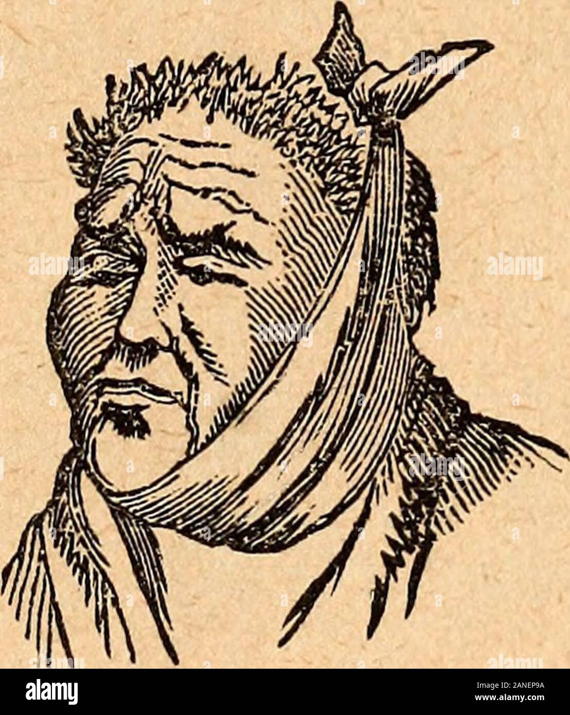 St anthonys fire hi-res stock photography and images - Alamy