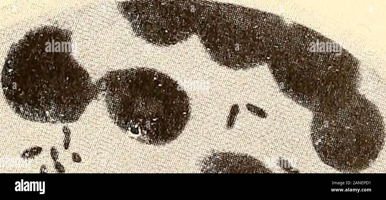 Principles and practice of operative dentistry . *ft , X. ?$&$* ^v. Fig ...