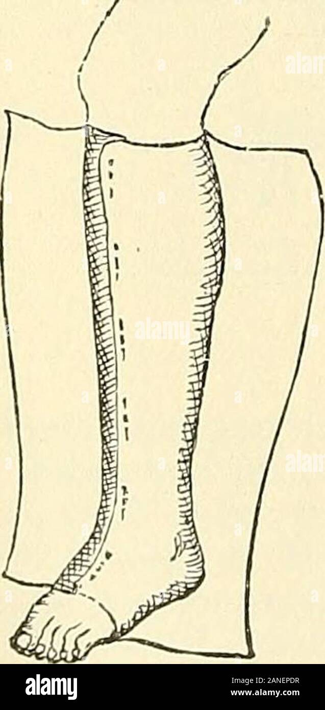 Dorsum of foot hi-res stock photography and images - Alamy