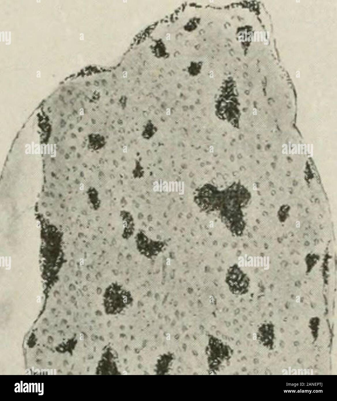 Diseases of the chest and the principles of physical diagnosis . tains ...