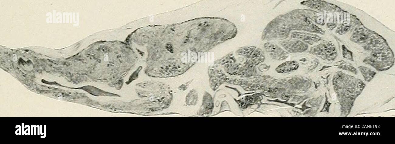 Diseases of the chest and the principles of physical diagnosis . Fig ...