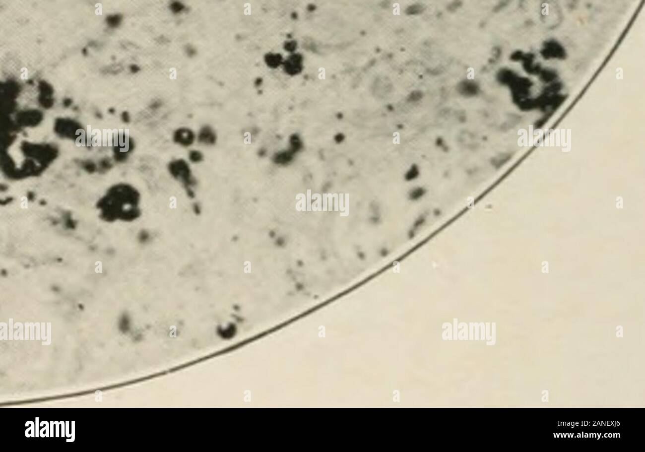 Cerebellum granular layer hi-res stock photography and images - Alamy