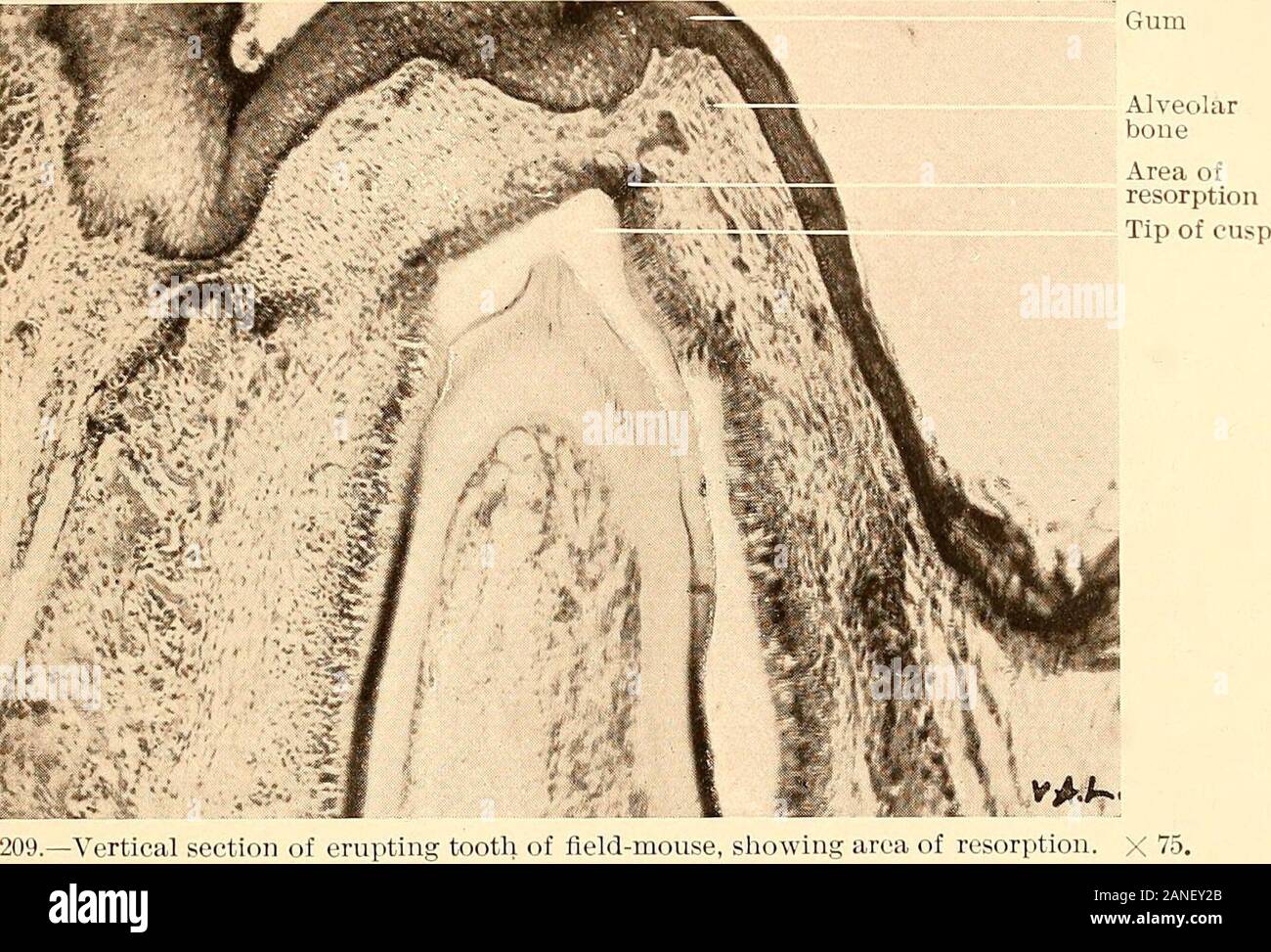 Principles and practice of operative dentistry . rocess of resorption ...