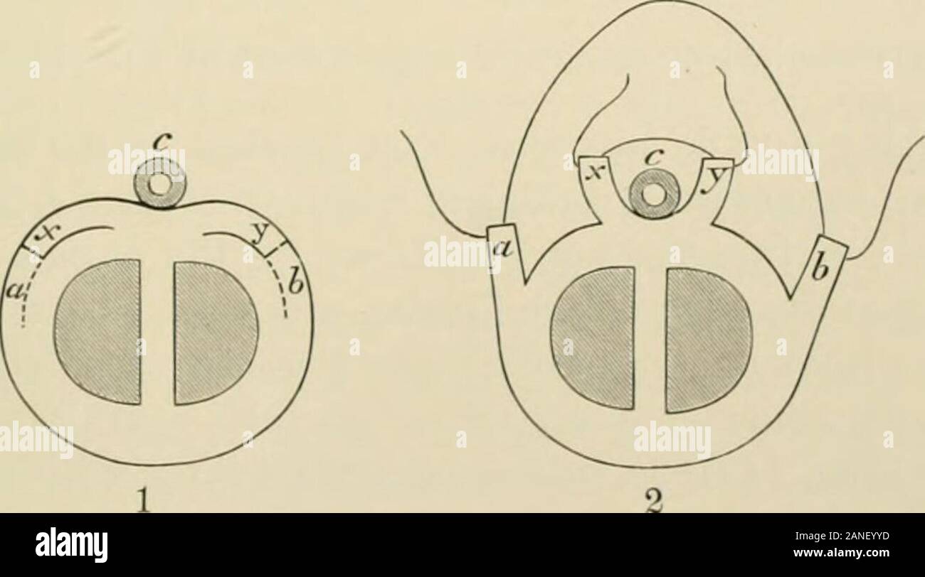 Hypospadias hi-res stock photography and images - Alamy