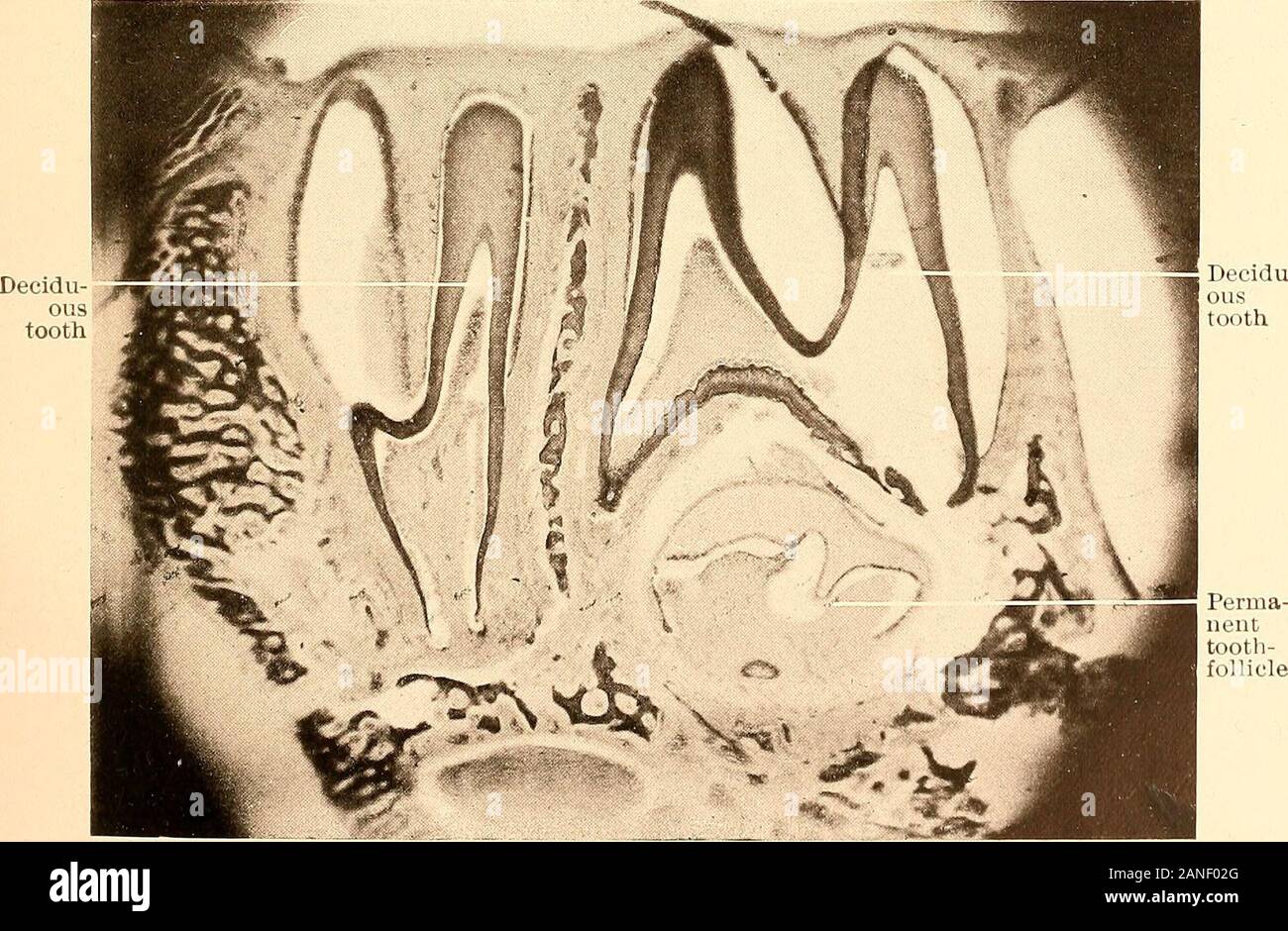 Principles and practice of operative dentistry . Fig. 205.—Vertical se ...