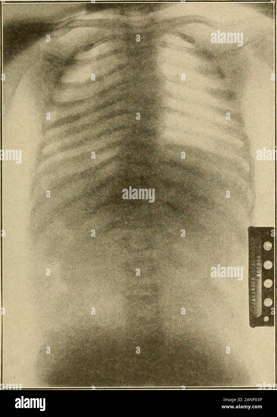 Jackets over shoulders hi-res stock photography and images - Alamy