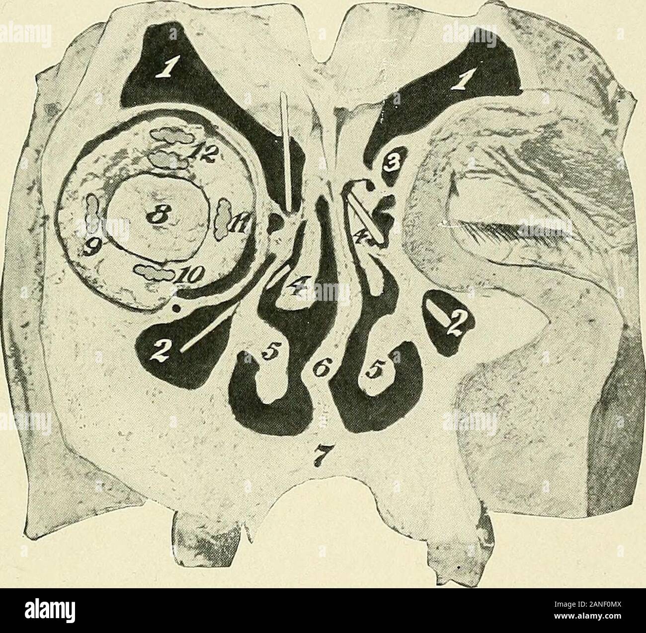 Branches of musculocutaneous nerve hi-res stock photography and images ...