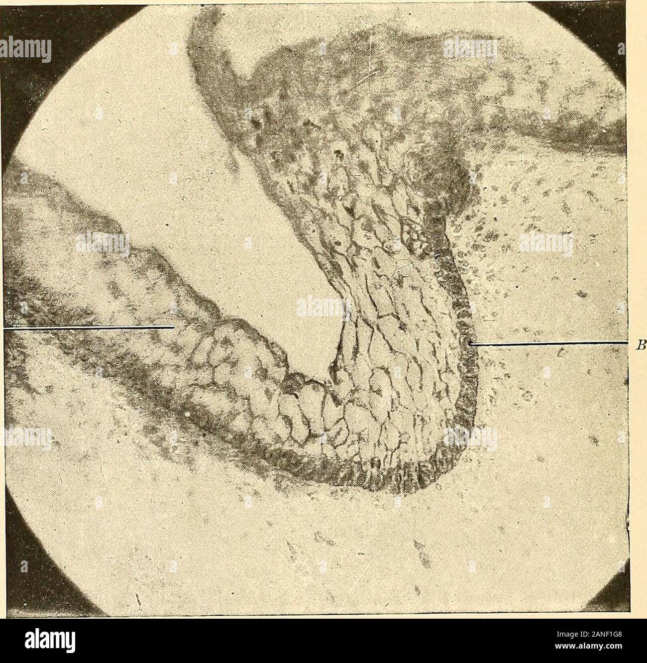 Principles and practice of operative dentistry . lands of Serres. X 50 ...