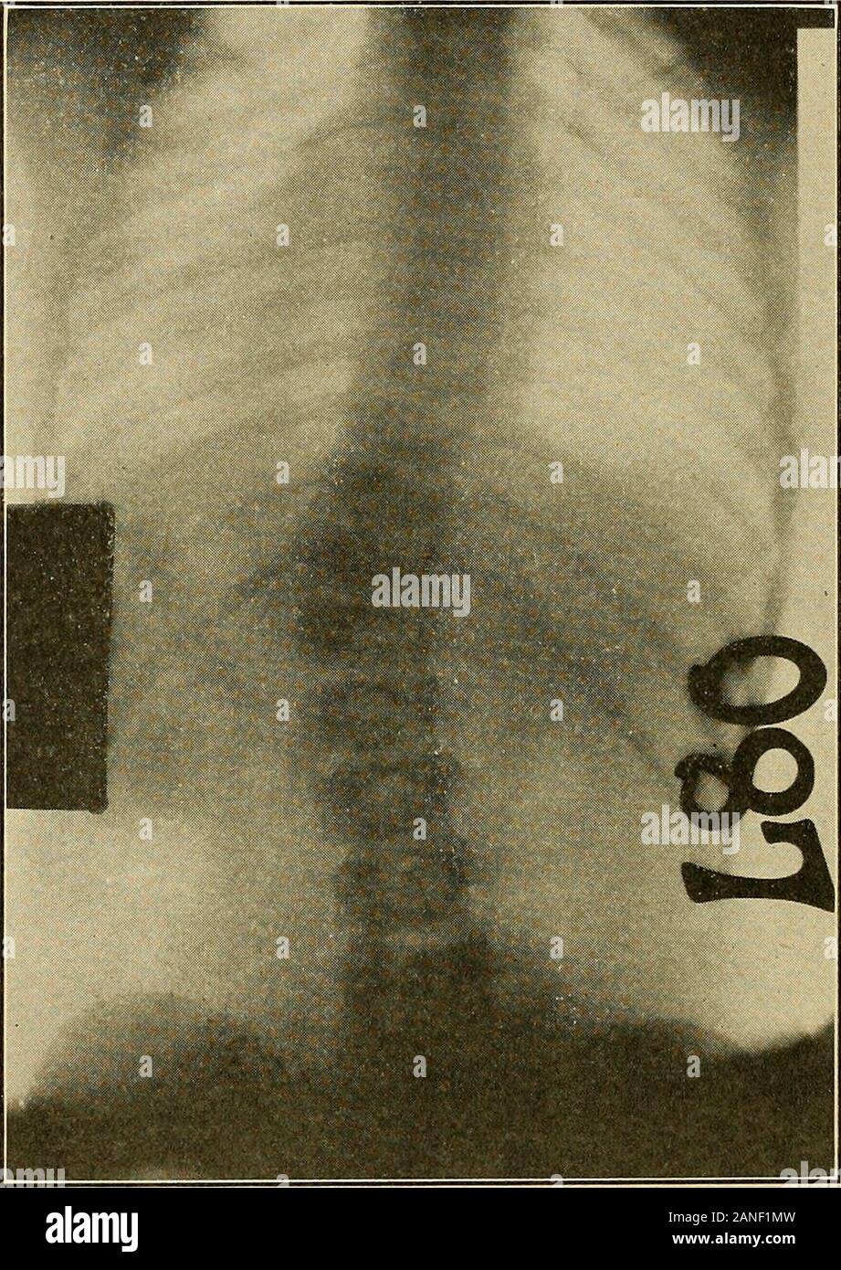 Osgood curve hi-res stock photography and images - Alamy