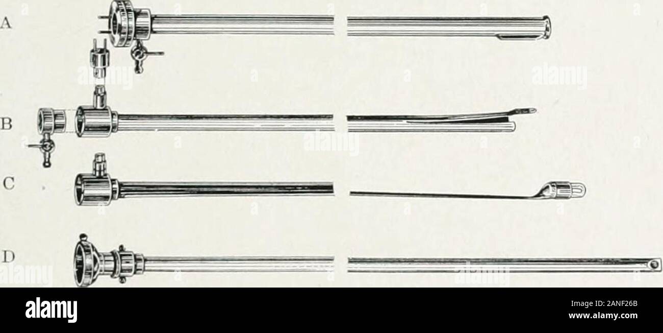 Endoscopy intestines hi-res stock photography and images - Alamy