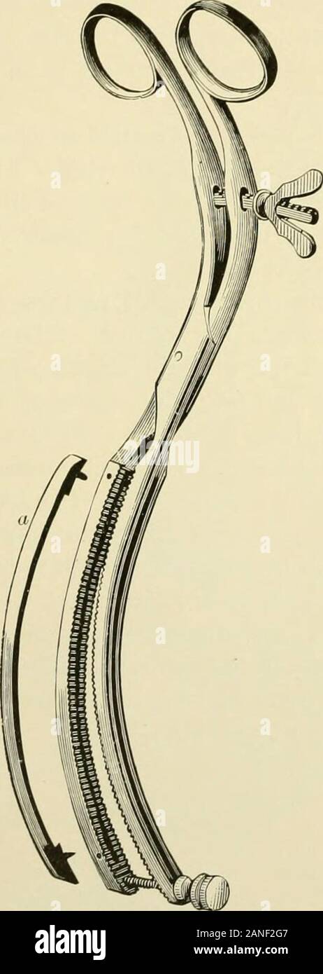 Scrotum surgery hi-res stock photography and images - Alamy