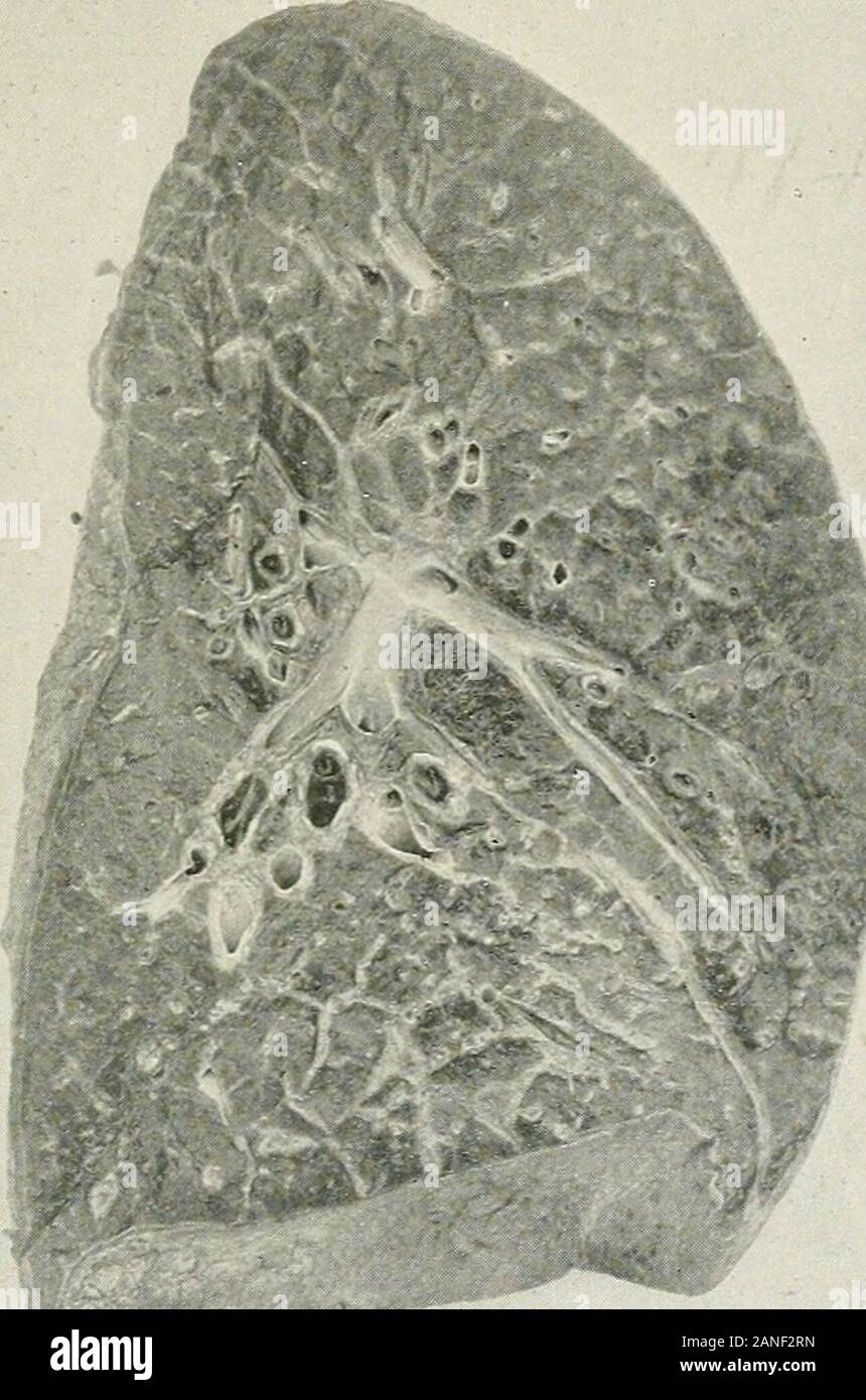 Diseases of the chest and the principles of physical diagnosis ...
